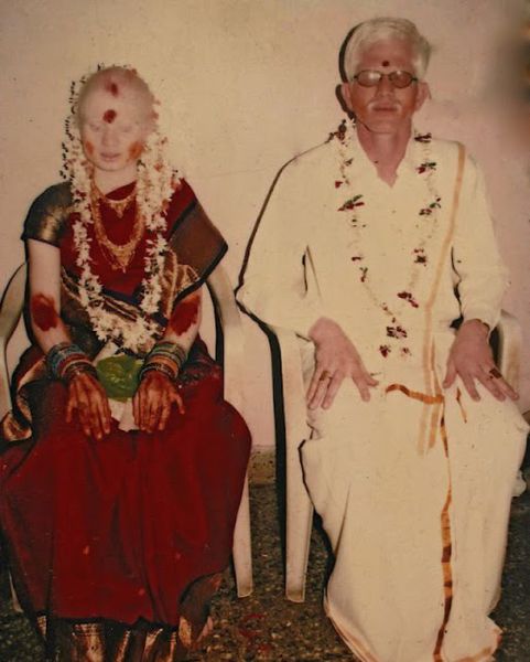 Largest Albino Family In The World - AboveWhispers